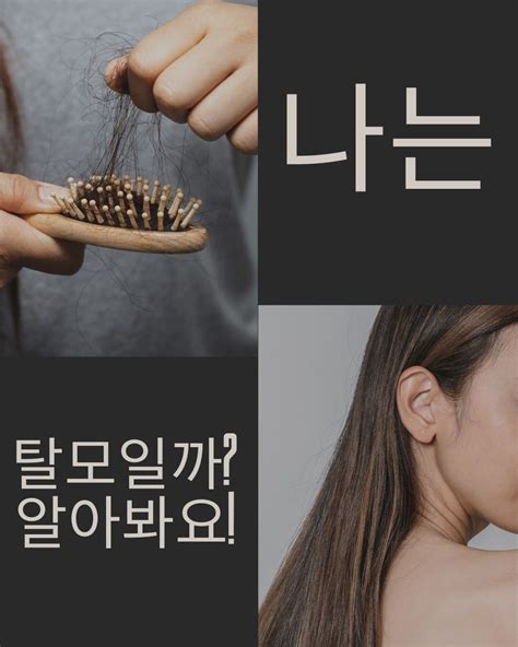 M자 이마 가리는 헤어스타일 And 관리 팁｜남녀별 커버 스타일과 탈모 보호 습관