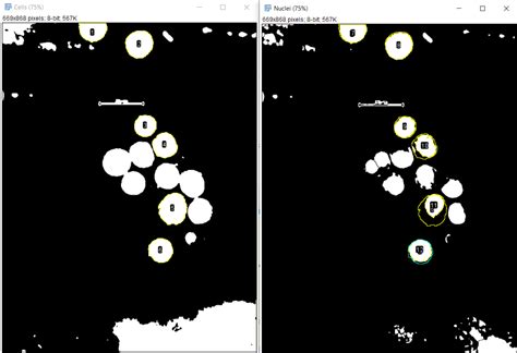 Urgent Imagej Nested Cell Segmentation Macro Image Analysis Image