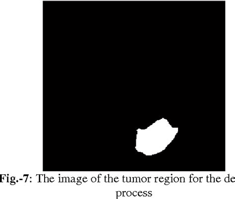 Figure 3 From Brain Tumor Detection And Segmentation Using Watershed Segmentation And