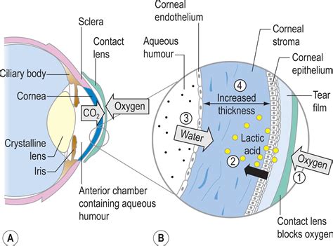 Anterior Eye Clinical Tree