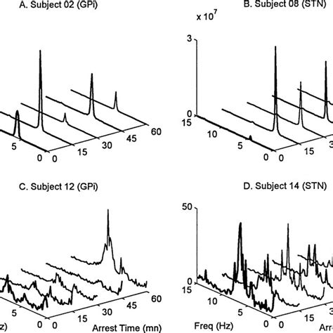 Rest Tremor Amplitude Measured By Part Iii Of The Updrs Item 20 And