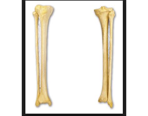 Tibia Unlabeled Tibia And Fibula