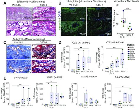 Serial Intralesional Steroid Injection Silsi Minimizes The