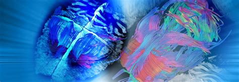 Dti Connectomics In Mouse Models Of Neurological Disorders Bruker