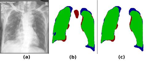 input images a before and b after histogram equalization download