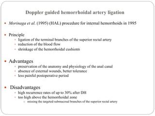 Hemorrhoidal Disease Pptx