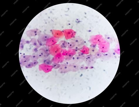 Frotis De Papanicolaou Bajo Microscopía Que Muestra Un Frotis