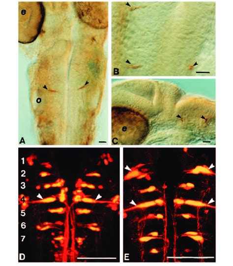 Duplication Of The Mauthner Neuron Occurs In R2 In Hoxa 1injected