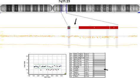 cytogenomic analysis of the proband showing the mlpa and snp array