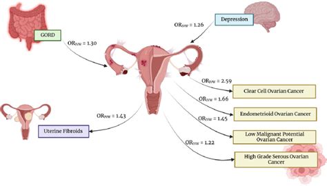 Causal Relationships With Endometriosis Determined Using Mendelian Download Scientific Diagram
