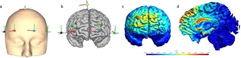 SimNIBS Simulation Of HD TDCS Study Set Up A Head Model Setup B Download Scientific