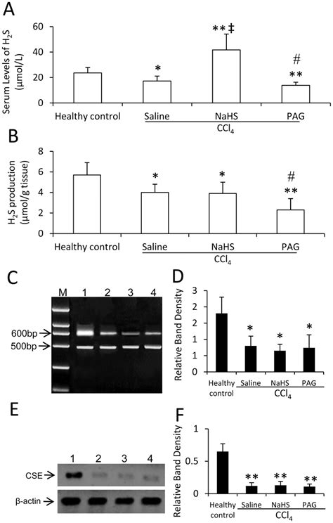serum levels of h2s h2s production and cse expression in ccl4 induced