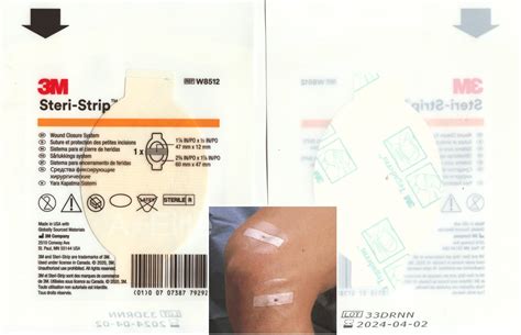 3m Steri Strip Wound Skin Closure System Clear First Aid Window