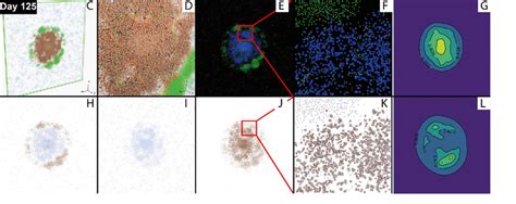 Visualization Of Spatio Temporal Tumor Dynamics A Simulated Tumor In