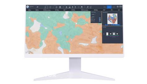 루닛 로슈진단 디지털병리 플랫폼에 ‘ai Pd L1 통합 바이오스펙테이터