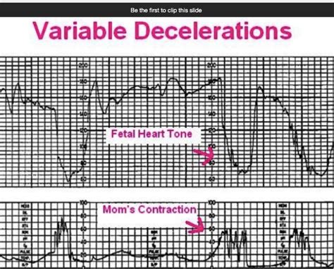 Med4yu Ctg Scenarios