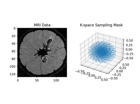 gpu non cartesian reconstruction with sense — pysap v0 2 1