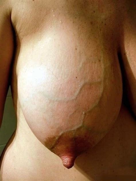 Thick Blue Veins Nightnurse