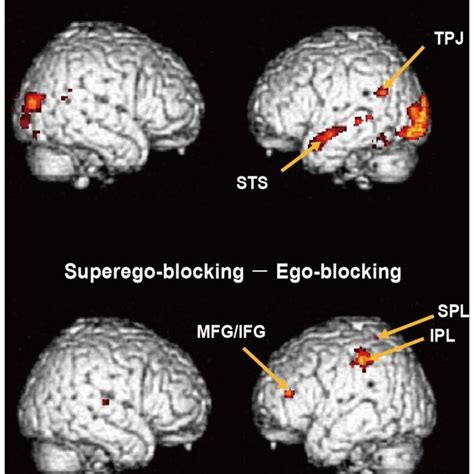 Pdf Extrapunitive And Intropunitive Individuals Activate Different