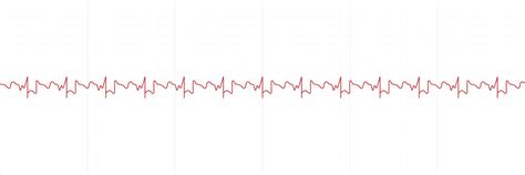 Premium Vector Electrocardiography Heartbeat Line Monitor Ecg