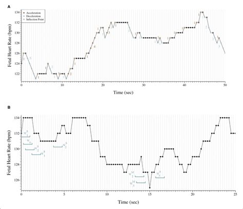 A Representation Of 50 S Of A Fetal Heart Rate Time Series Sampled Download Scientific