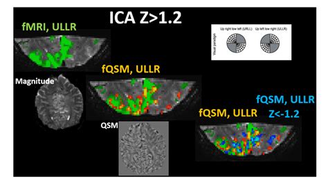 Pdf Discrimination Of Volumes With Positive And Negative Functional Qsm Activation Within Fmri