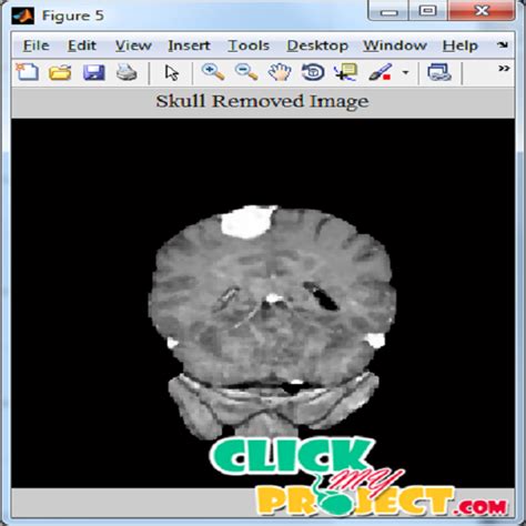 3d Brain Atlas Reconstruction Using Deformable Medical Image