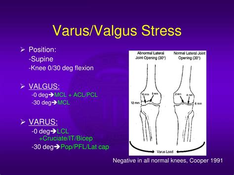 Ppt The Knee Clinical Evaluation Powerpoint Presentation Free