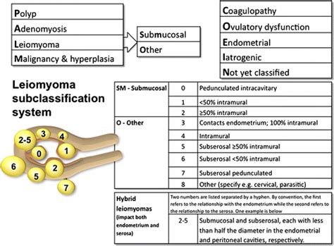Leiomyoma Subclassification System Republished With Permission From Download Scientific