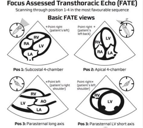 How To Do A Bedside Echo At Edward Gratwick Blog