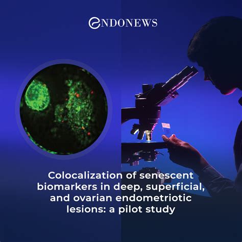 Creating A Reliable Indirect Immunofluorescence Protocol As A Promising Diagnostic Tool For