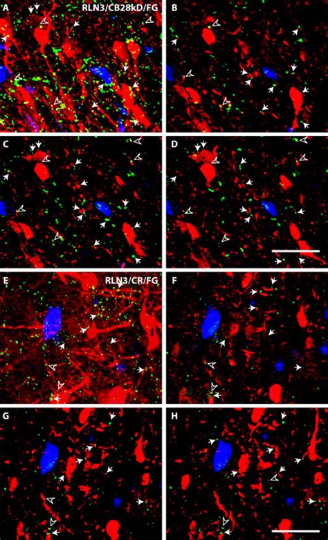 Confocal Images Illustrating The Colocalization Of Rln3 With