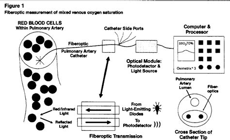Pdf Applications Of Continuous Mixed Venous Oxygen Saturation