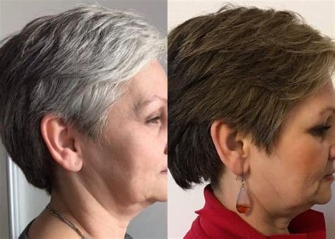 Grey Hair Treatment Gr 7 Professional