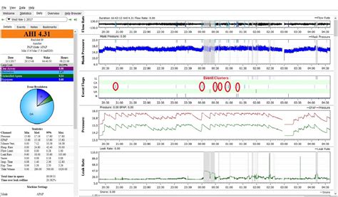 Filemoderate Clustering Charts Apnea Board Wiki