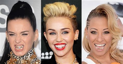 Celebrities With Grills