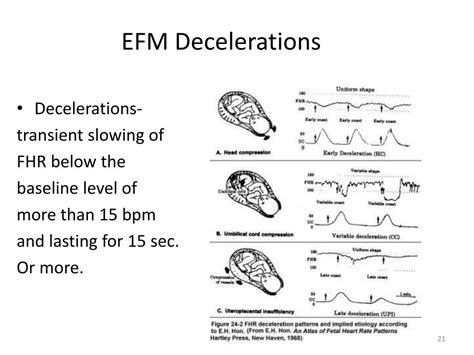 Ppt Fetal Monitoring Ante And Intrapartum Powerpoint Presentation Free Download Id 2271917