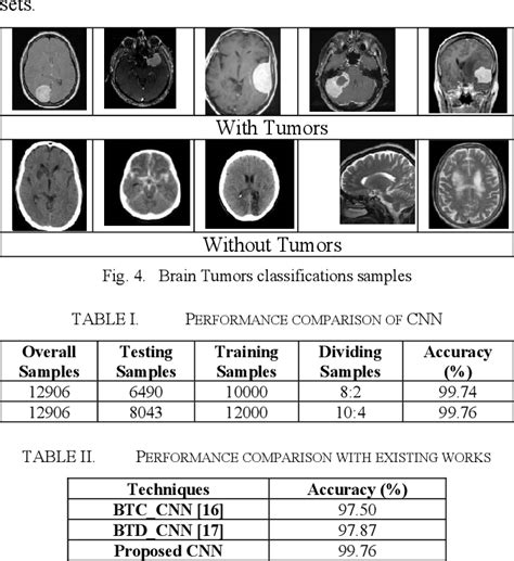 figure 4 from cnn based deep learning approach for mri based brain