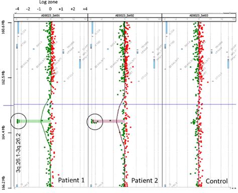 Cgh Findings In Two Patients And Another Fsgs Patient In The Two Download Scientific Diagram