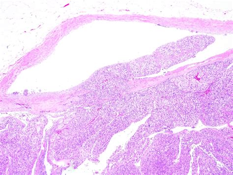 Pathology Outlines Features To Report