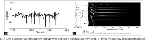 Figure 2 From The State Of The Art In Feature Extraction Methods For Electroencephalogram