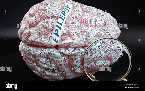 Epilepsy In Human Brain A Concept Showing Hundreds Of Crucial Words