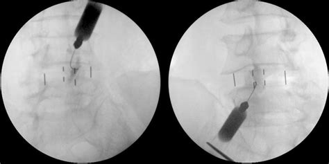 The Journal Of Bone And Joint Surgery Inc On Linkedin Intraoperative