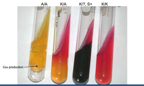 Microbio 150 Lab Exam 1 PVCC Flashcards Quizlet