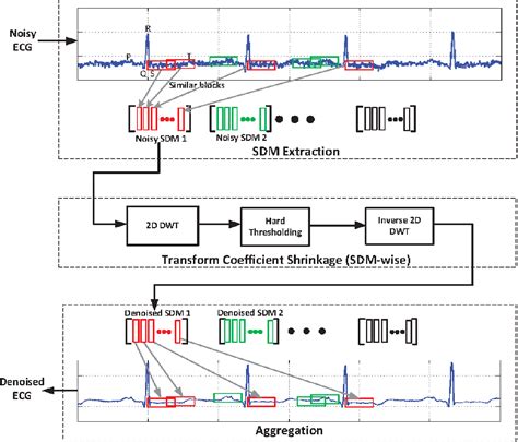 figure 1 from electrocardiogram signal denoising using non local