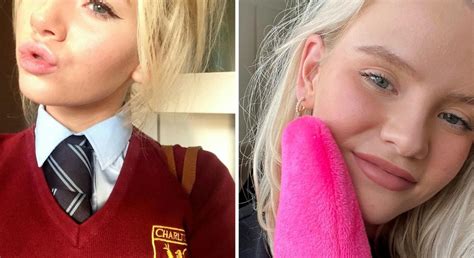 Woman Bullied For Her Acne Launches Make Up Remover Business