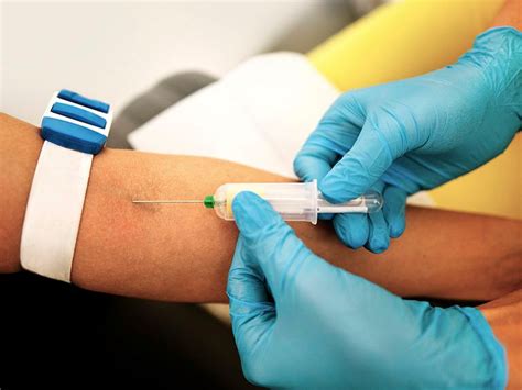 RPR Test Purpose Procedure And Results 51 OFF