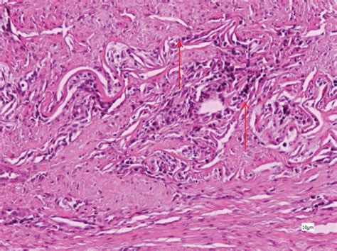 surgical site urethra histological observation 4 w after operation a