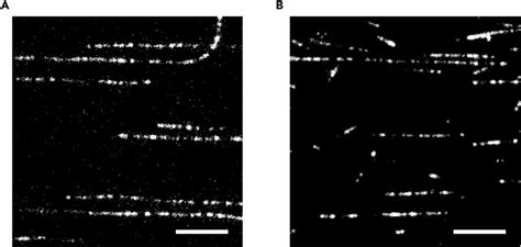 Representative Total Internal Reflection Fluorescence Tirf Microscopy Download Scientific