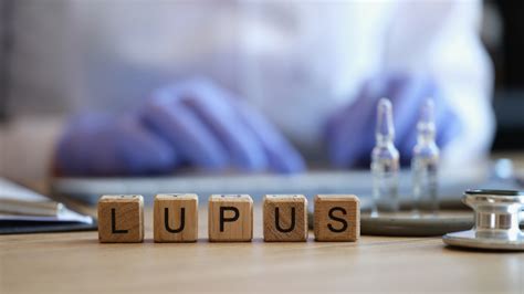 Understanding Lupus Symptoms Diagnosis And Treatment